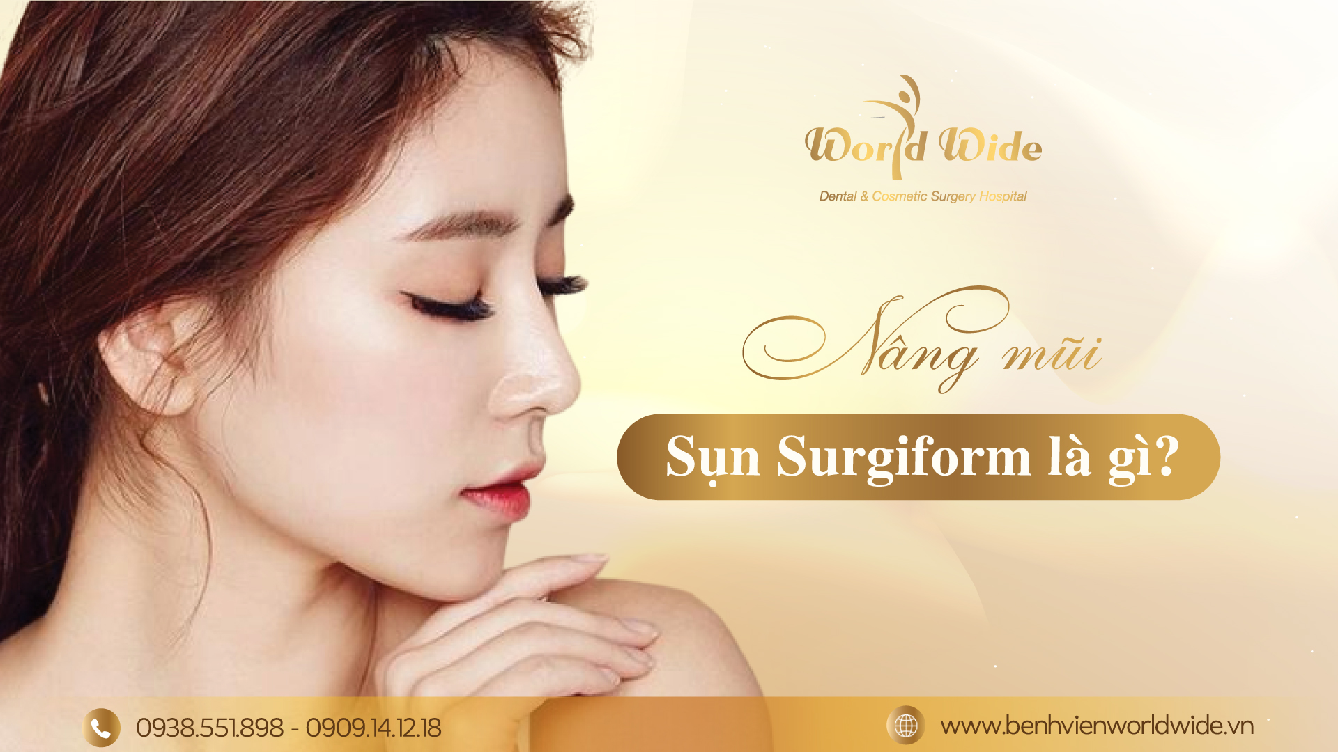 Nâng Mũi Sụn Surgiform Là Gì?